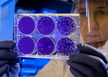 Learn how to use biological indicators in your sterilization cycle